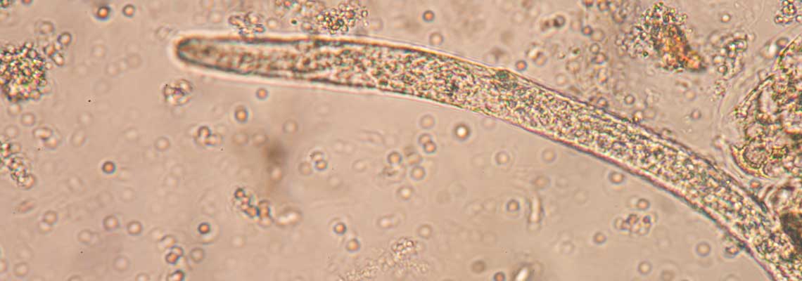 Parasitic Worm Increases Fertility in Women - Fertilitytips.com